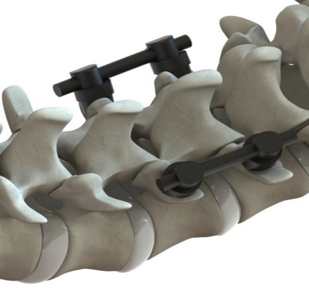 Products – Endocare Asia